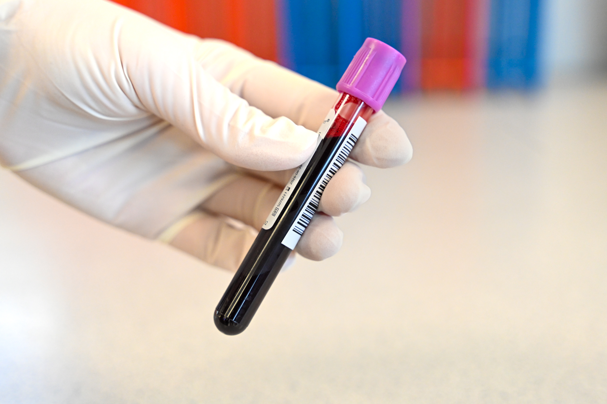 High‑quality blood products for advanced research | Gulf Coast Blood ...